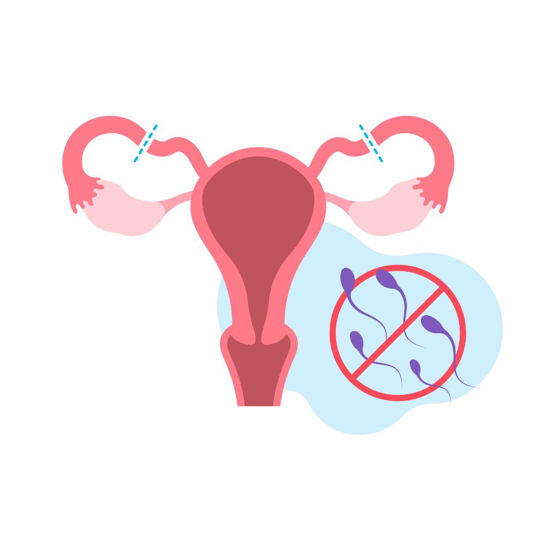 Emergency Contraception: Harper College